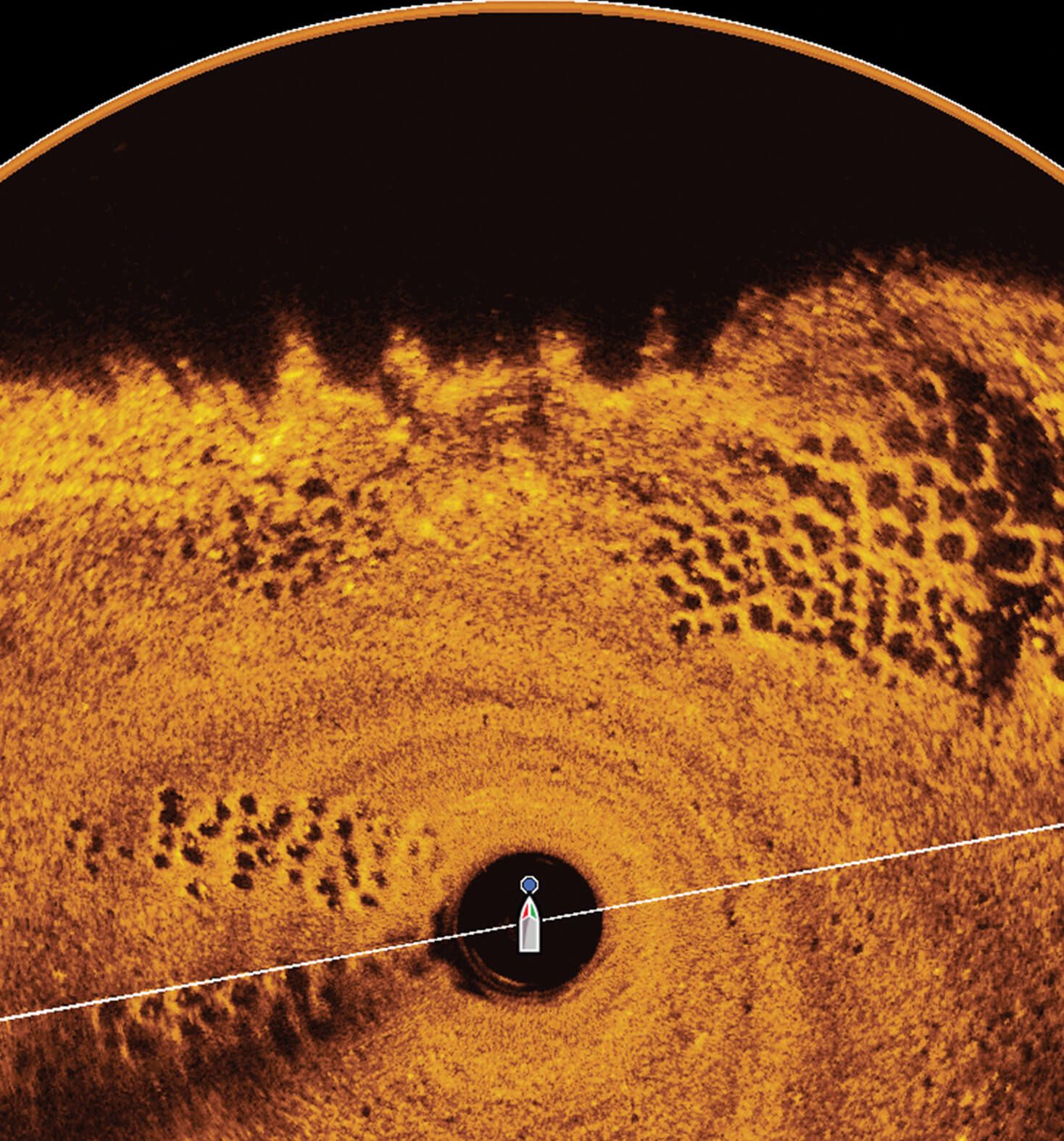 MEGA 360 Imaging® - Humminbird