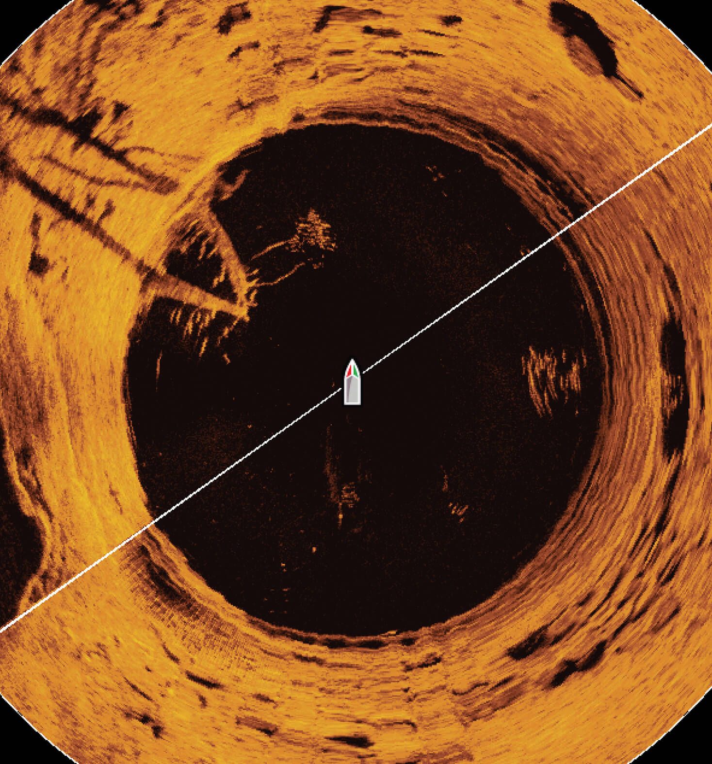 MEGA 360 Imaging® - Humminbird