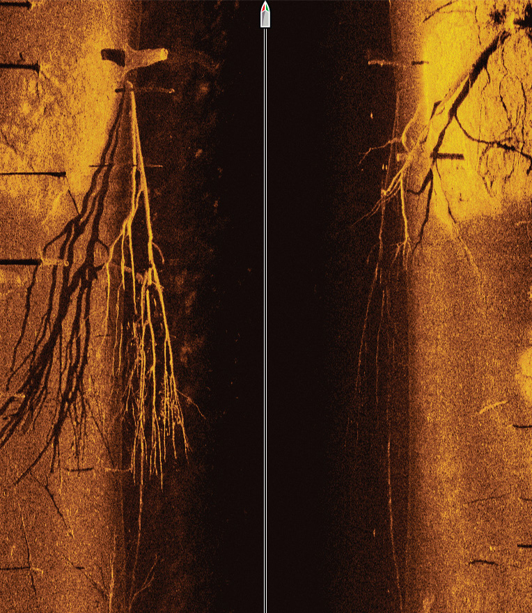 Humminbird® 101 - Humminbird